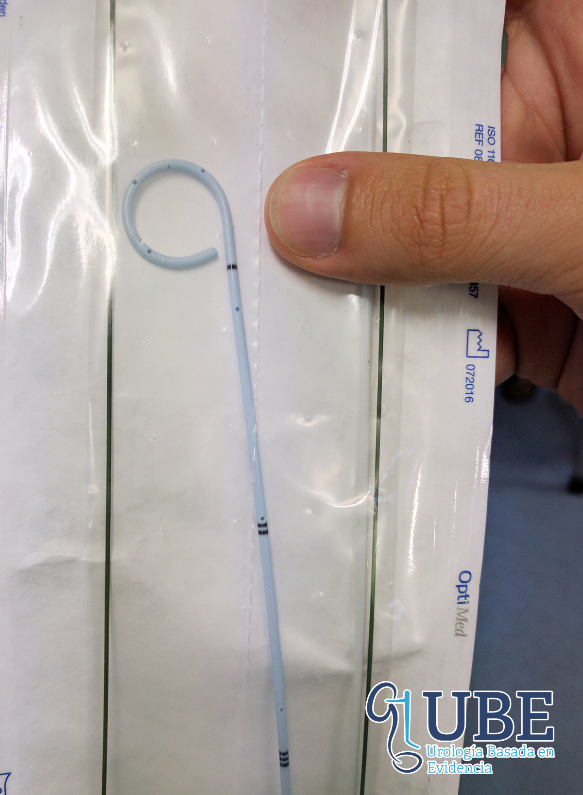 ¿Qué es un catéter doble J? – Urología Basada en Evidencia