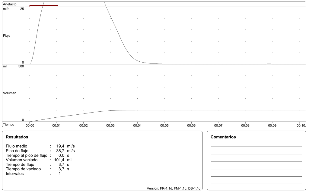 Uroflujometría ¿Qué es y cómo se hace? – Urología Basada en Evidencia